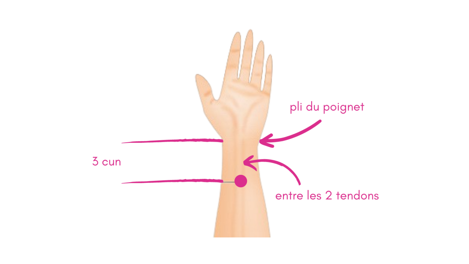 Point MC6 : repérage, explications & fonctions - Mélissa Carré