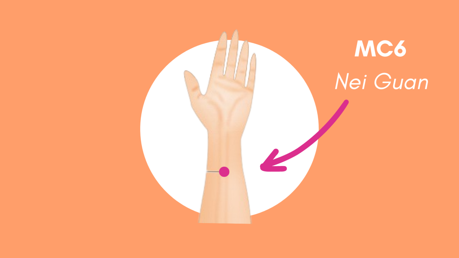 Point MC6 : repérage, explications & fonctions - Mélissa Carré